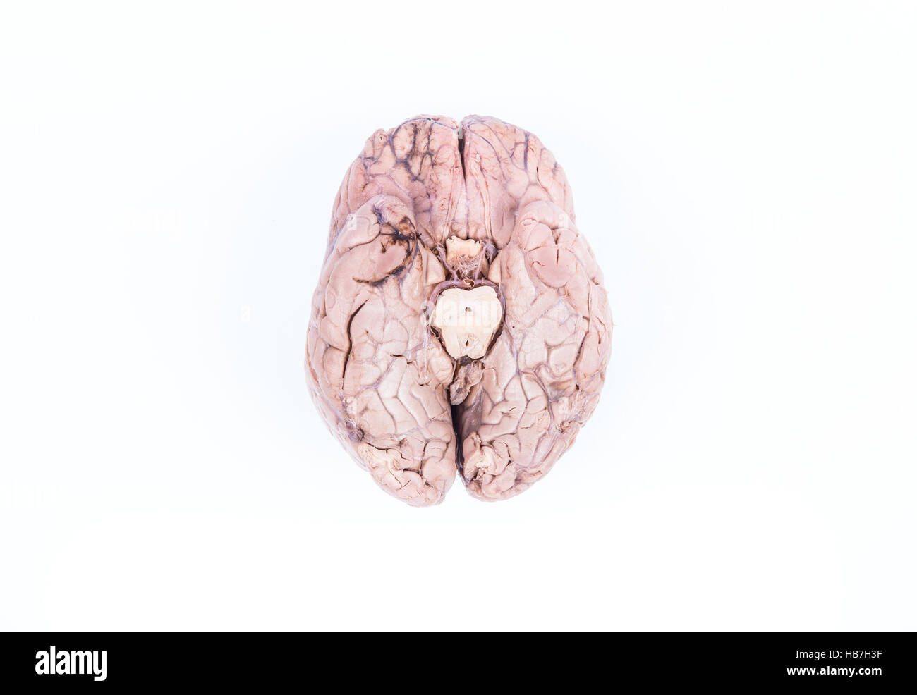 Real human brain anatomy Cut Out Stock Images & Pictures - Alamy