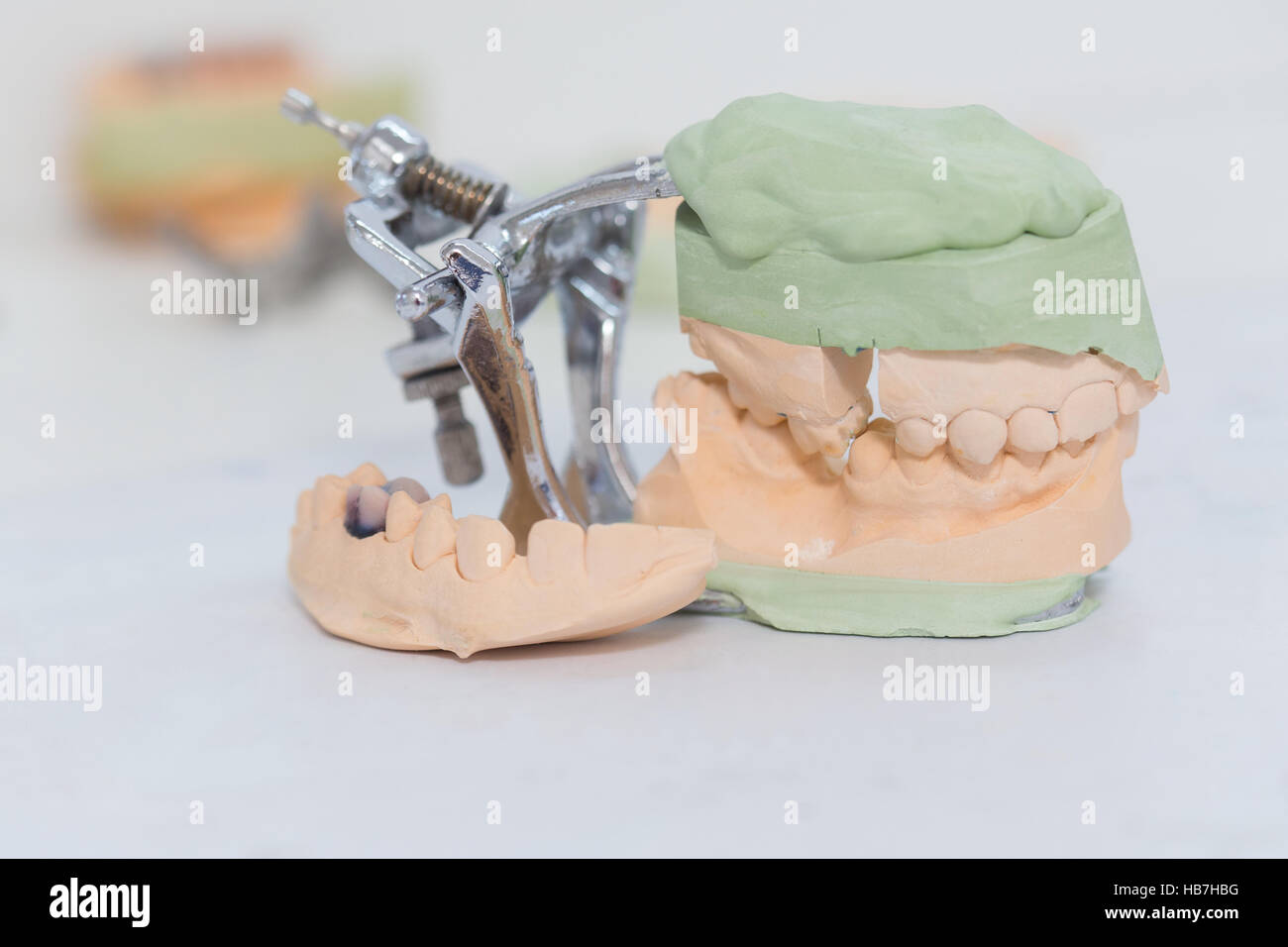 dental cast model in a laboratory with a waxep up tooth Stock Photo - Alamy
