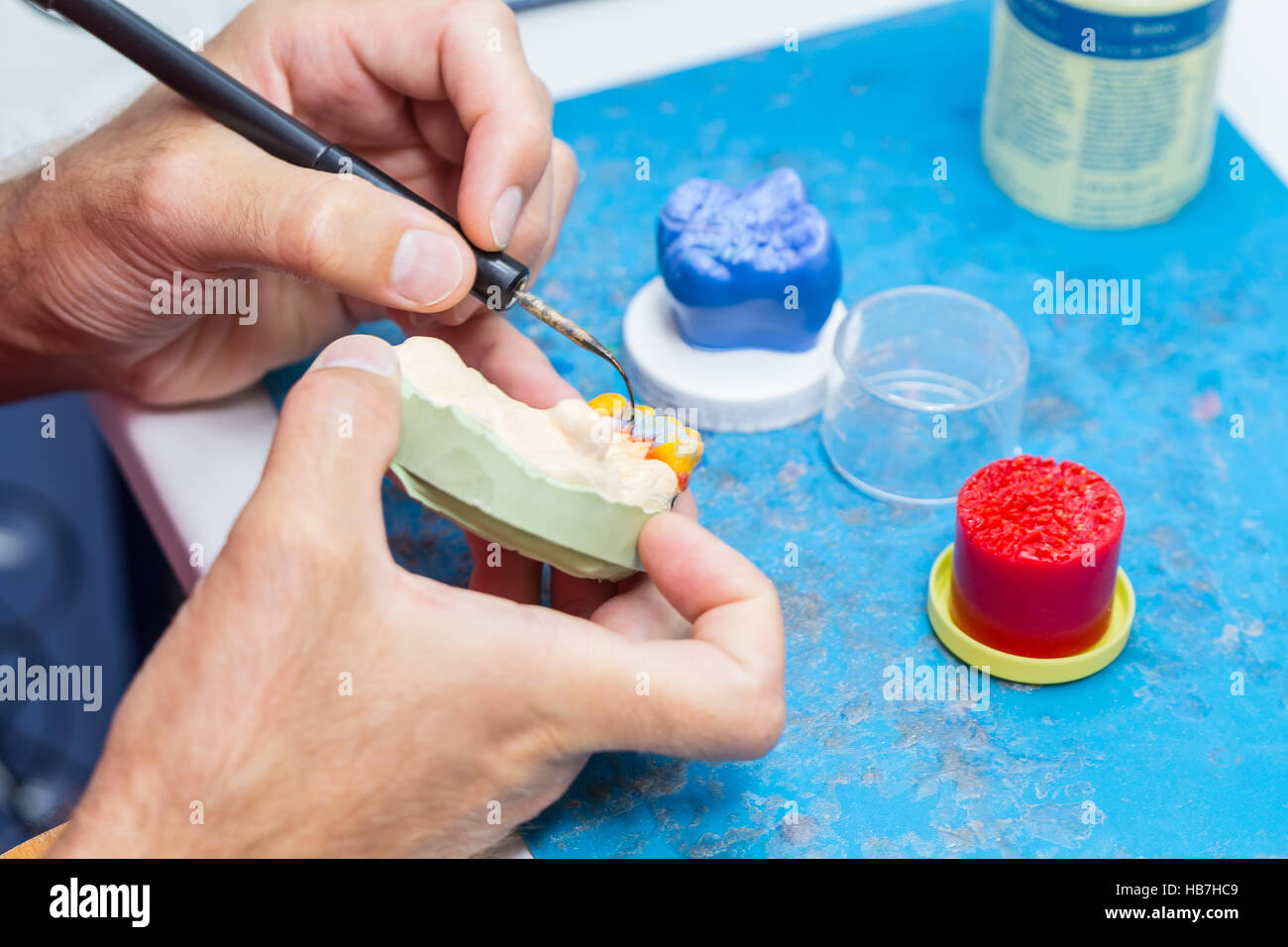 A dental technician remodeling with wax the support teeth after ...