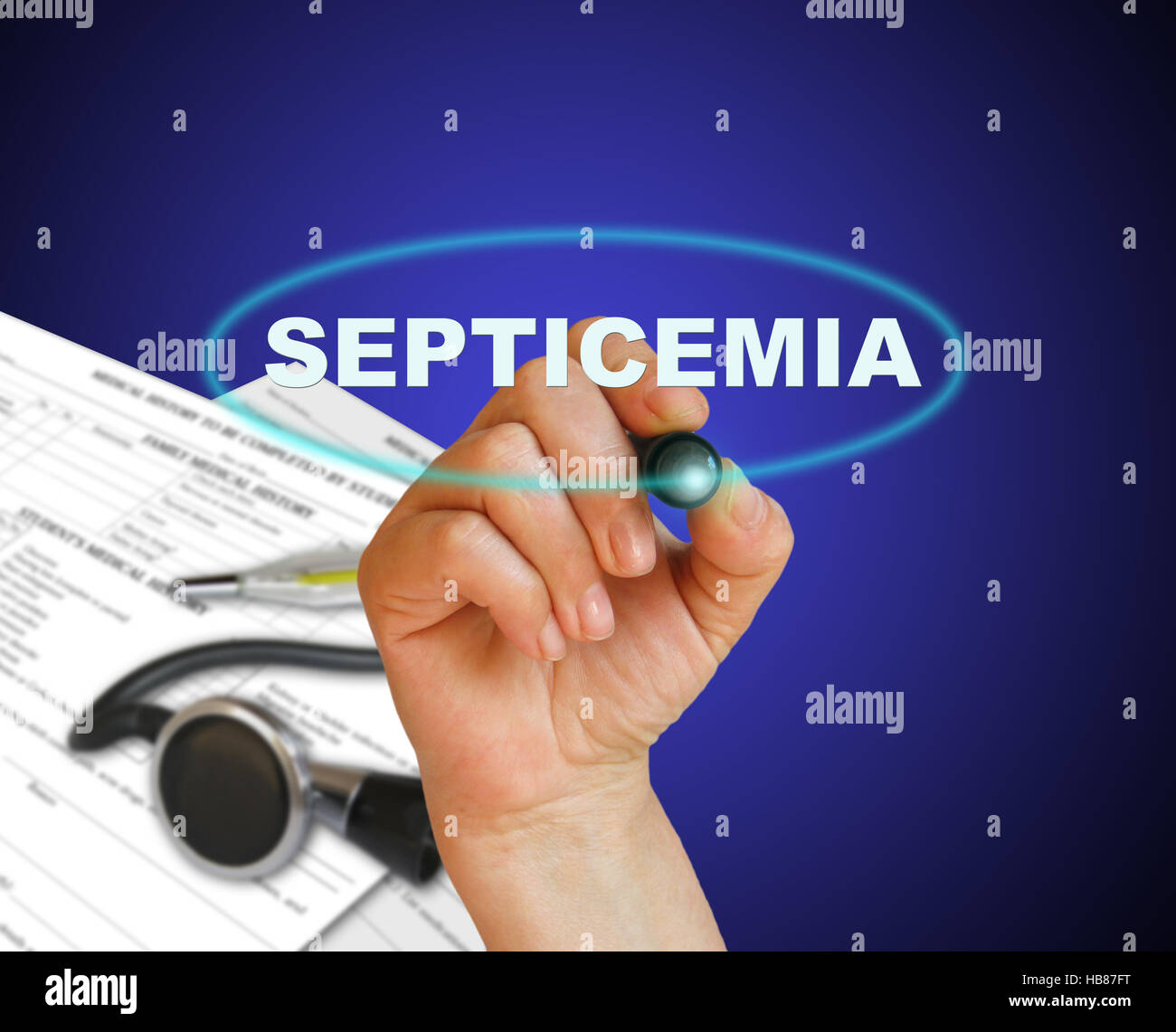 Septicemia hi-res stock photography and images - Alamy