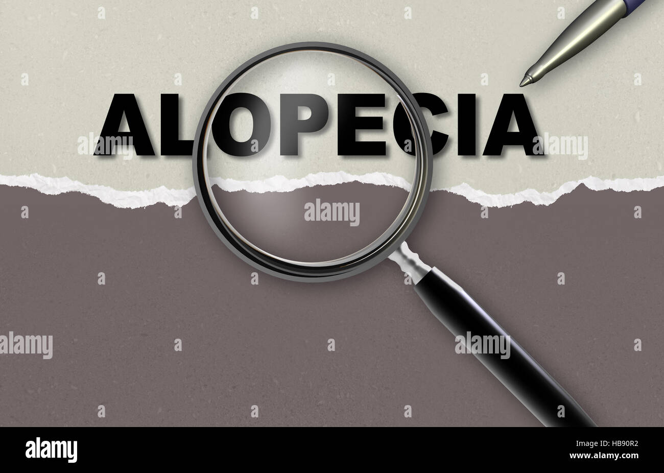 Pressure alopecia hi-res stock photography and images - Alamy