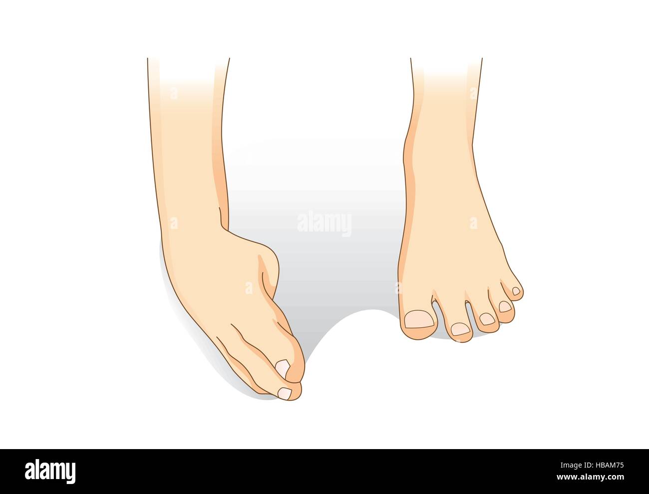 Ankle sprain pain Stock Vector Images - Alamy