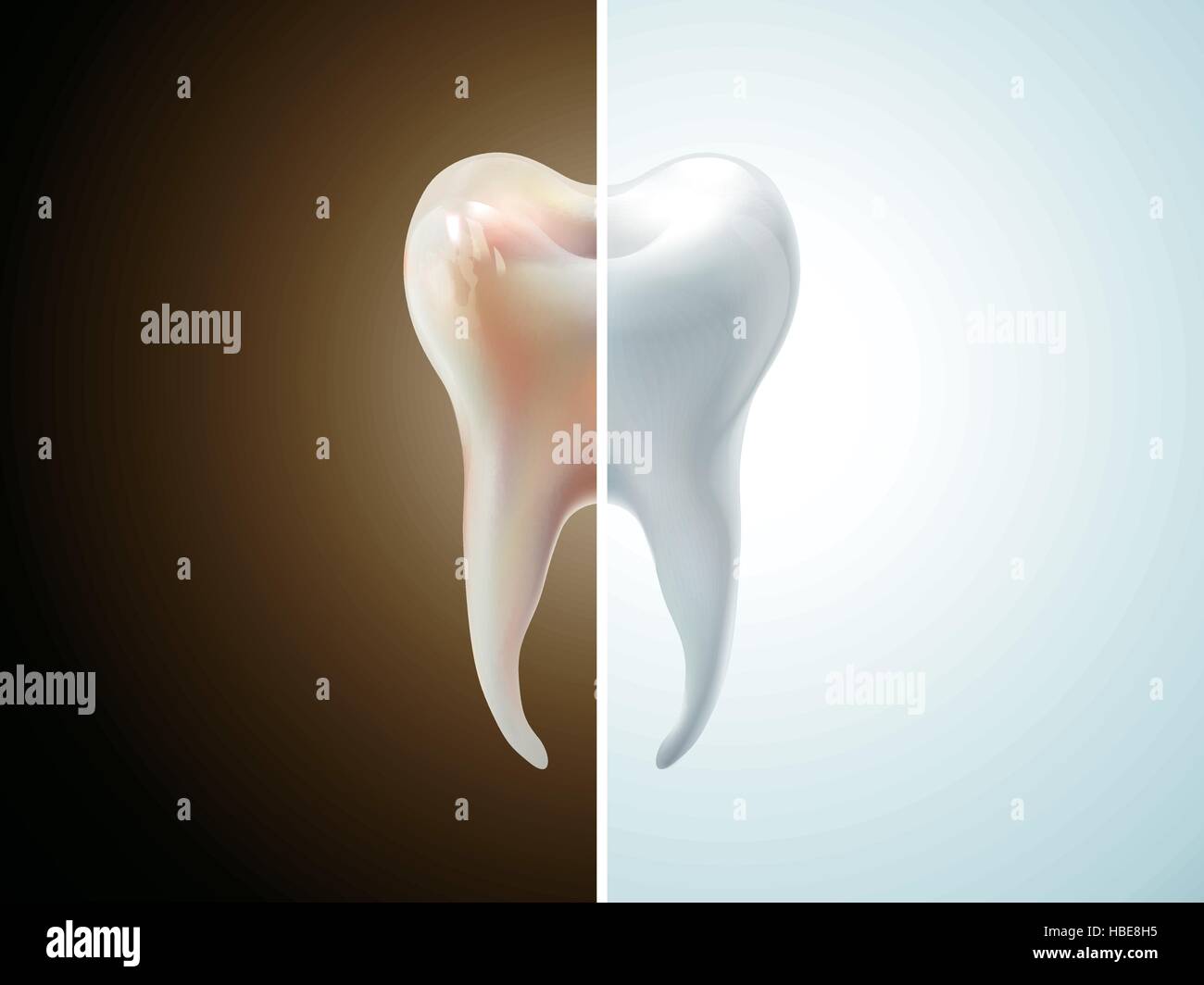 comparison of tooth care 3D illustration - pearl white and dirty tooth ...