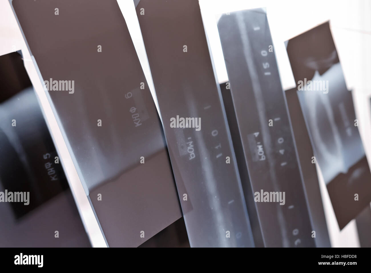 Radiographic pipe hi-res stock photography and images - Alamy