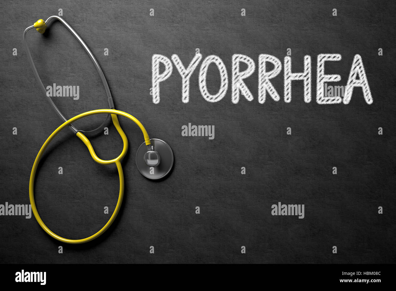 Pyorrhea High Resolution Stock Photography and Images - Alamy