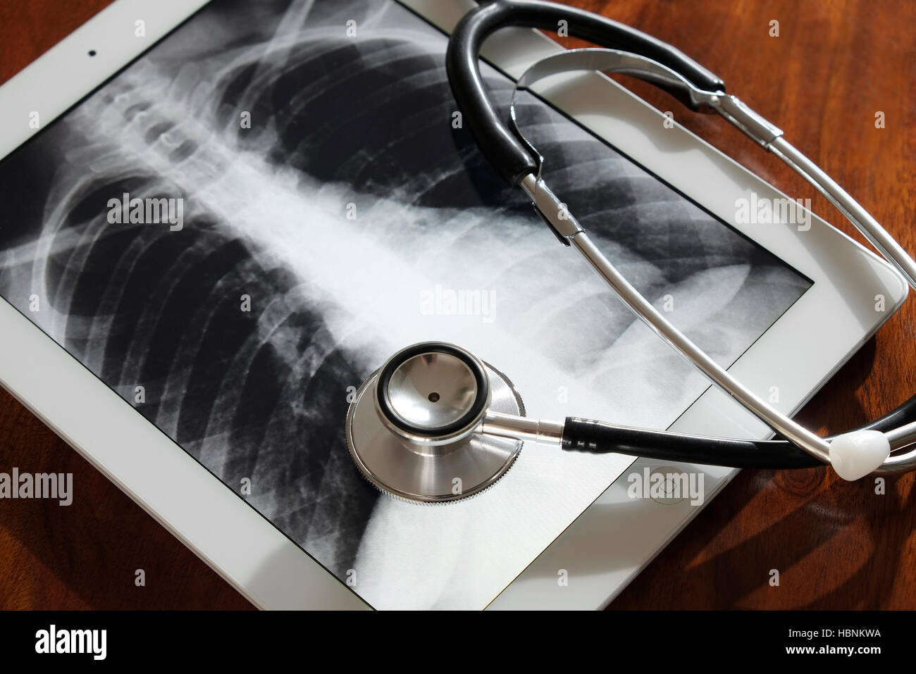Chest ribs hi-res stock photography and images - Alamy