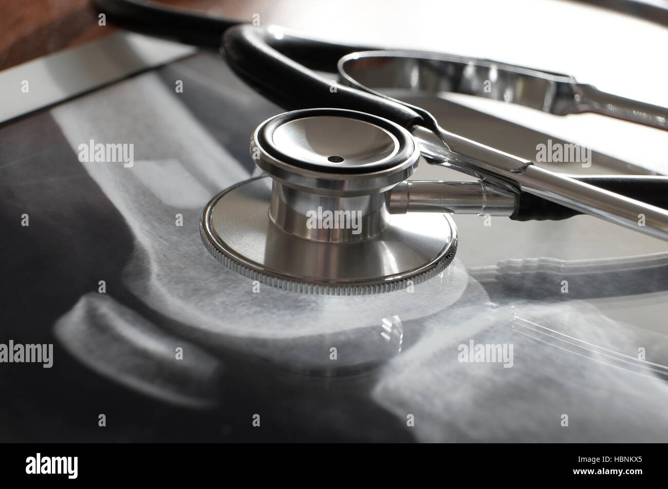 Ray image on monitor hi-res stock photography and images - Alamy