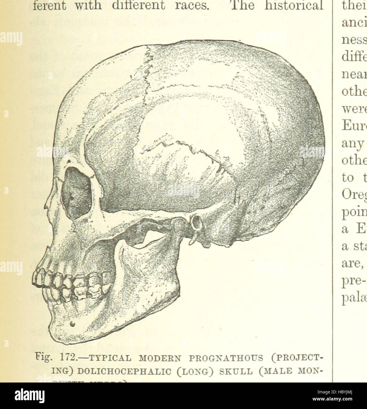 Prognathous hi-res stock photography and images - Alamy