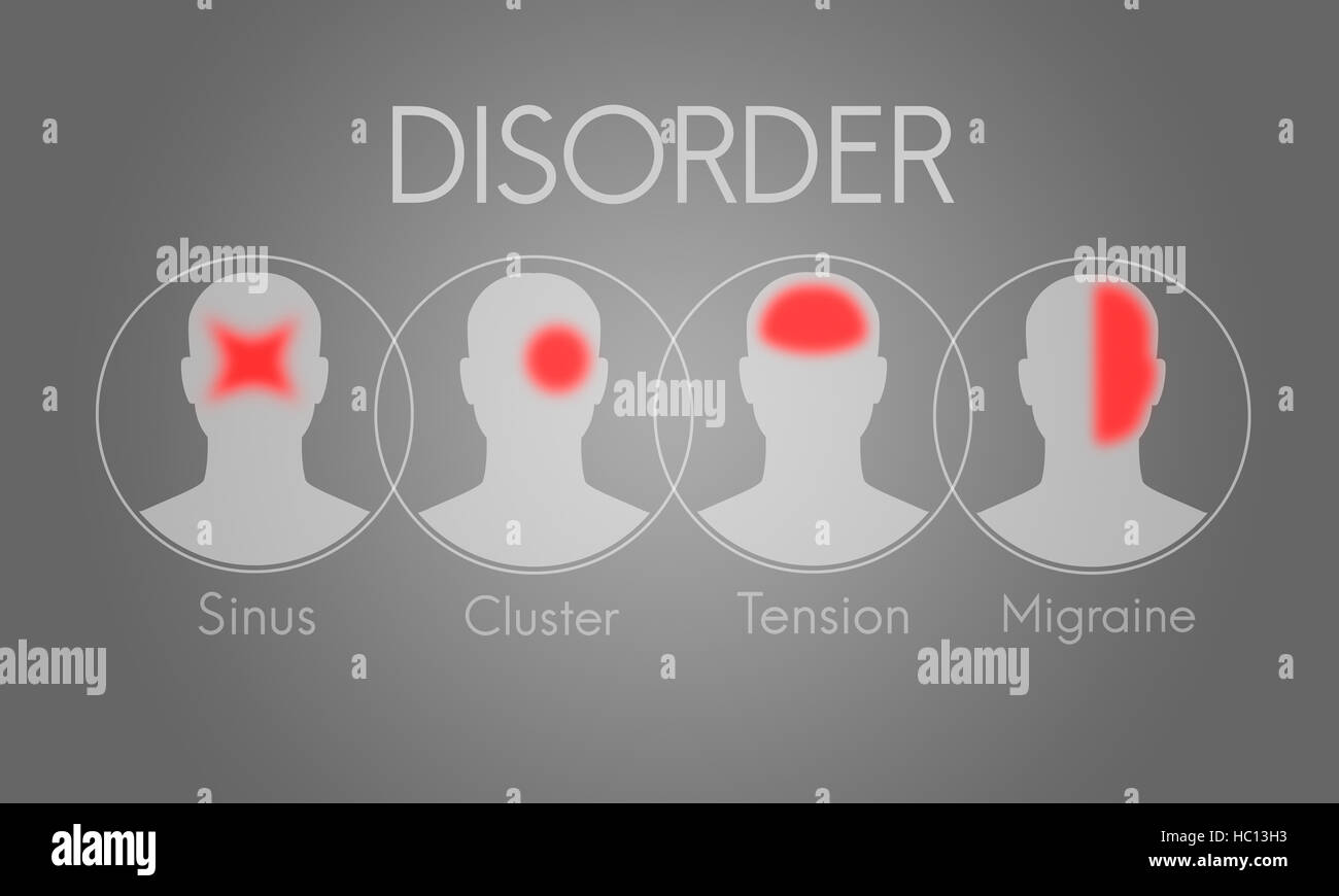 Cluster headache hi-res stock photography and images - Alamy Cluster headache hi-res stock photography and images - Alamy