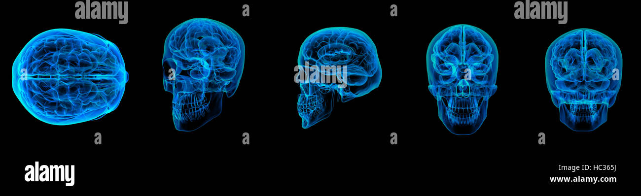 3d render human brain X ray Stock Photo - Alamy