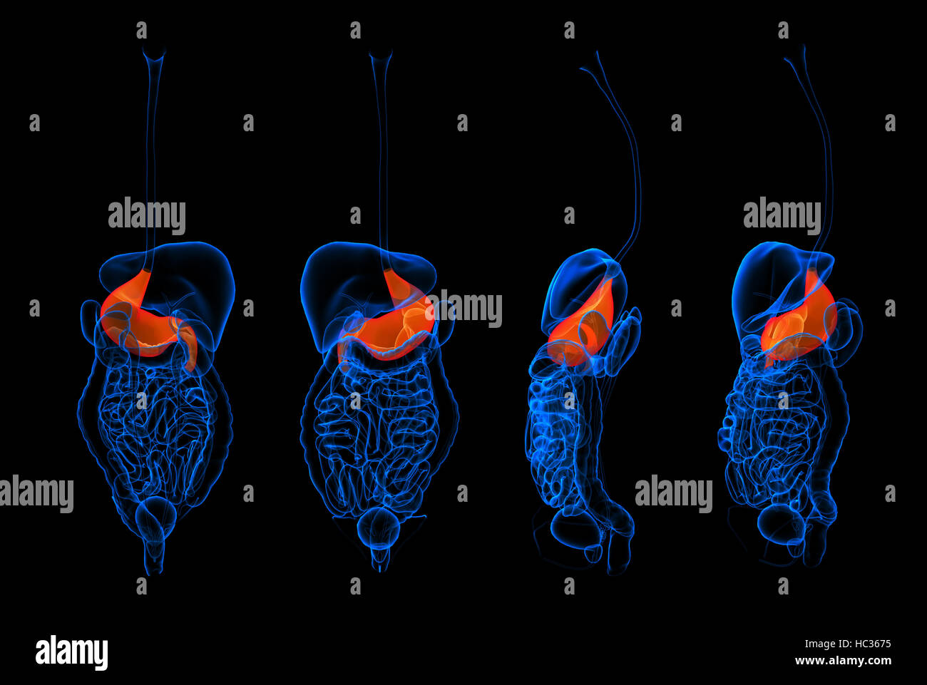 Cirrhosis abdomen hi-res stock photography and images - Alamy