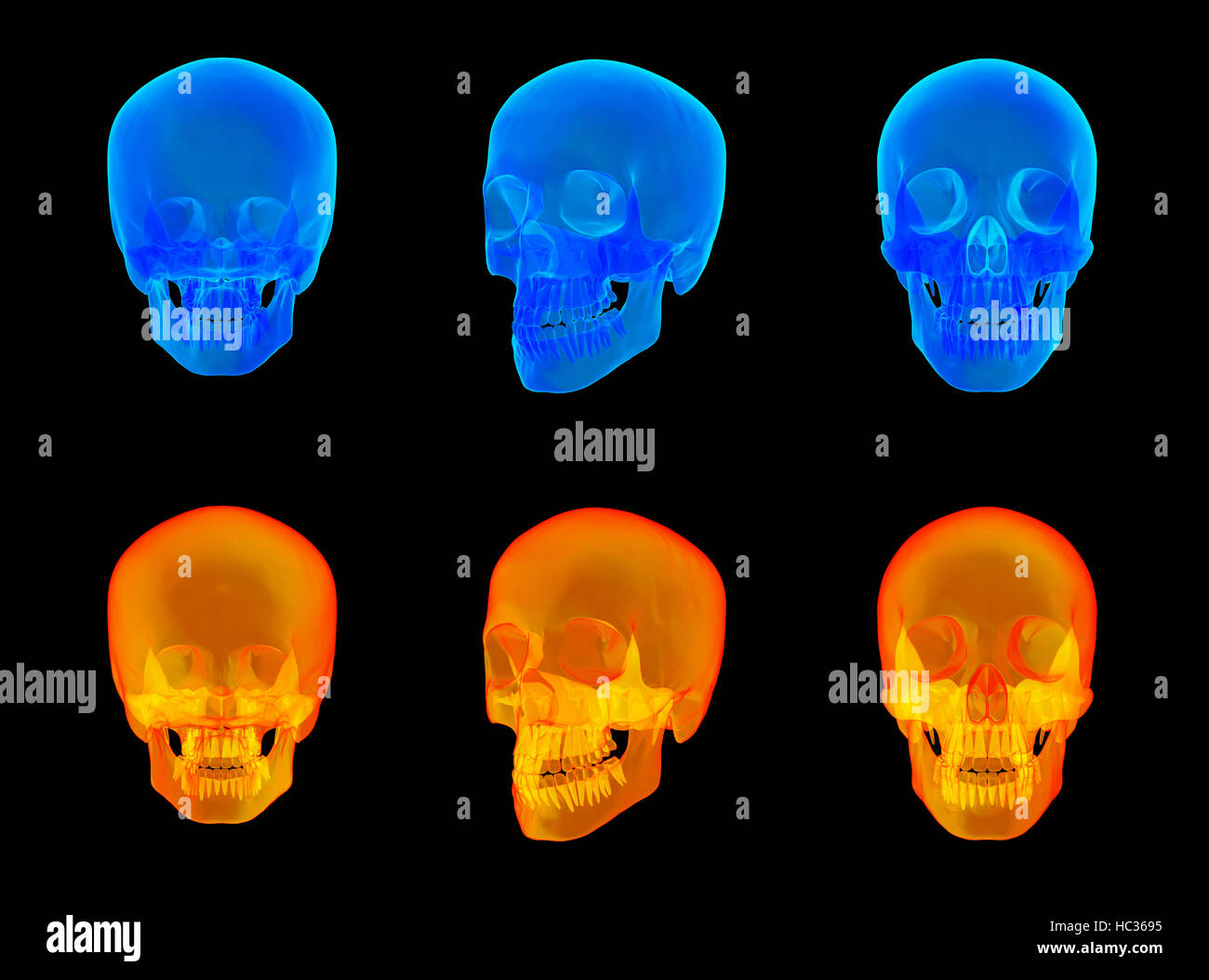 Front skull x ray image hi-res stock photography and images - Alamy