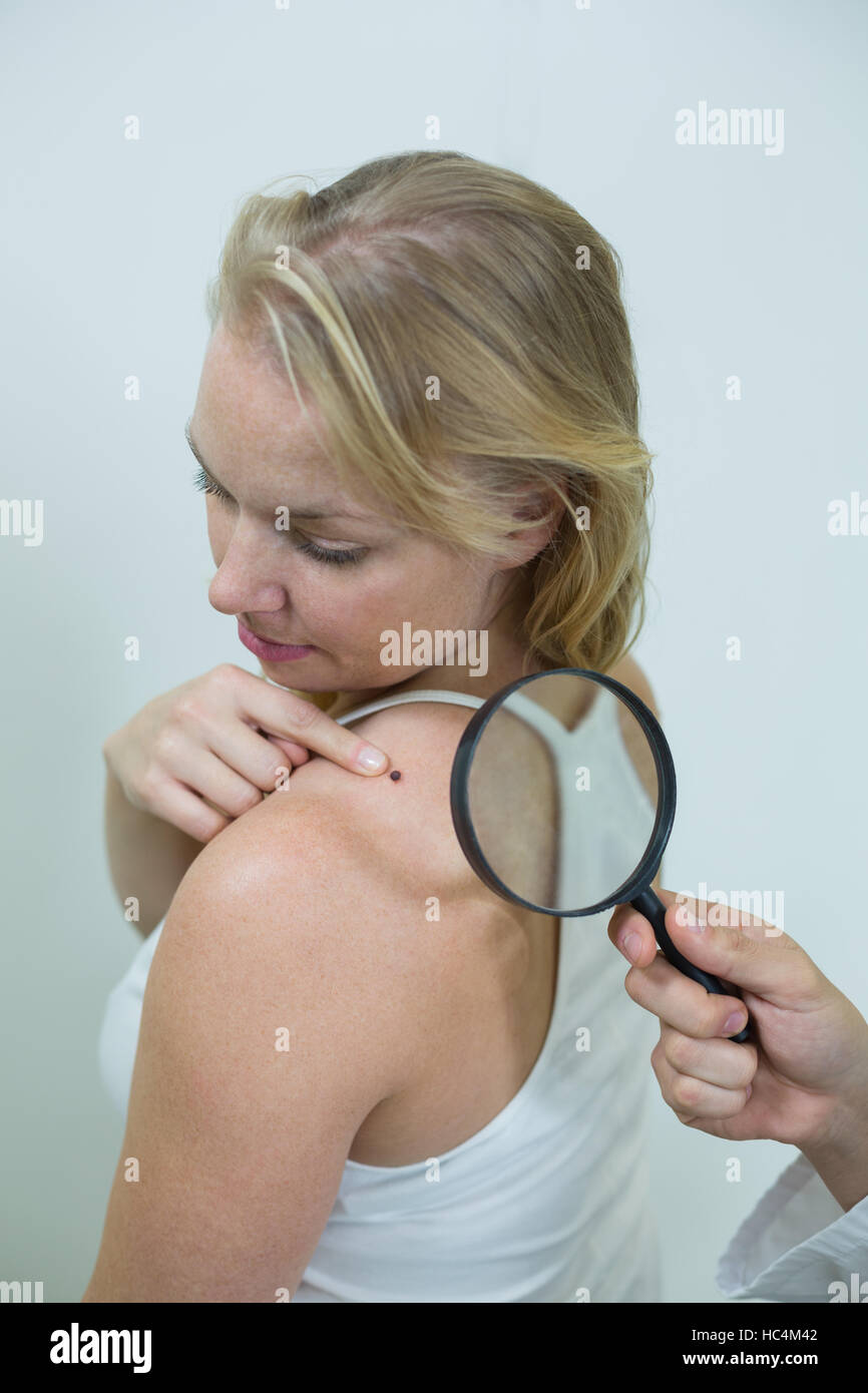Magnifying glass mole hi-res stock photography and images - Alamy