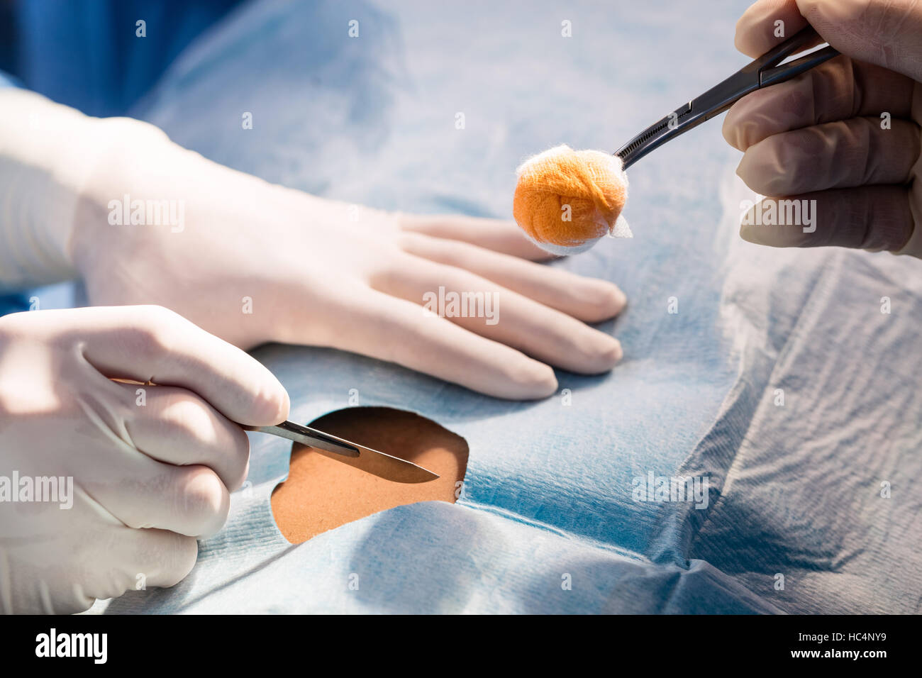Performing operation hi-res stock photography and images - Alamy