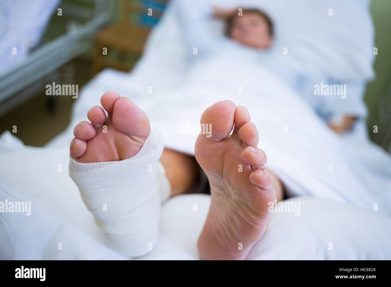 Patient with broken leg in a plaster cast Stock Photo - Alamy