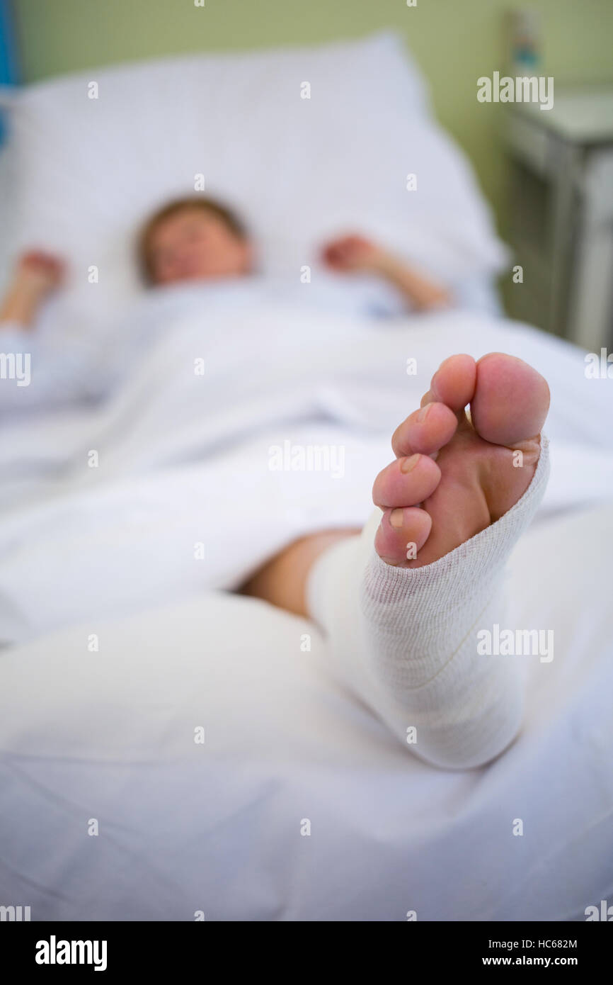 Hospital plaster cast leg hi-res stock photography and images - Alamy