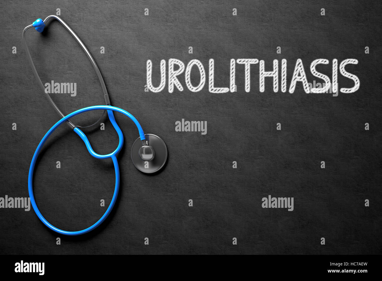 Urolithiasis hi-res stock photography and images - Alamy