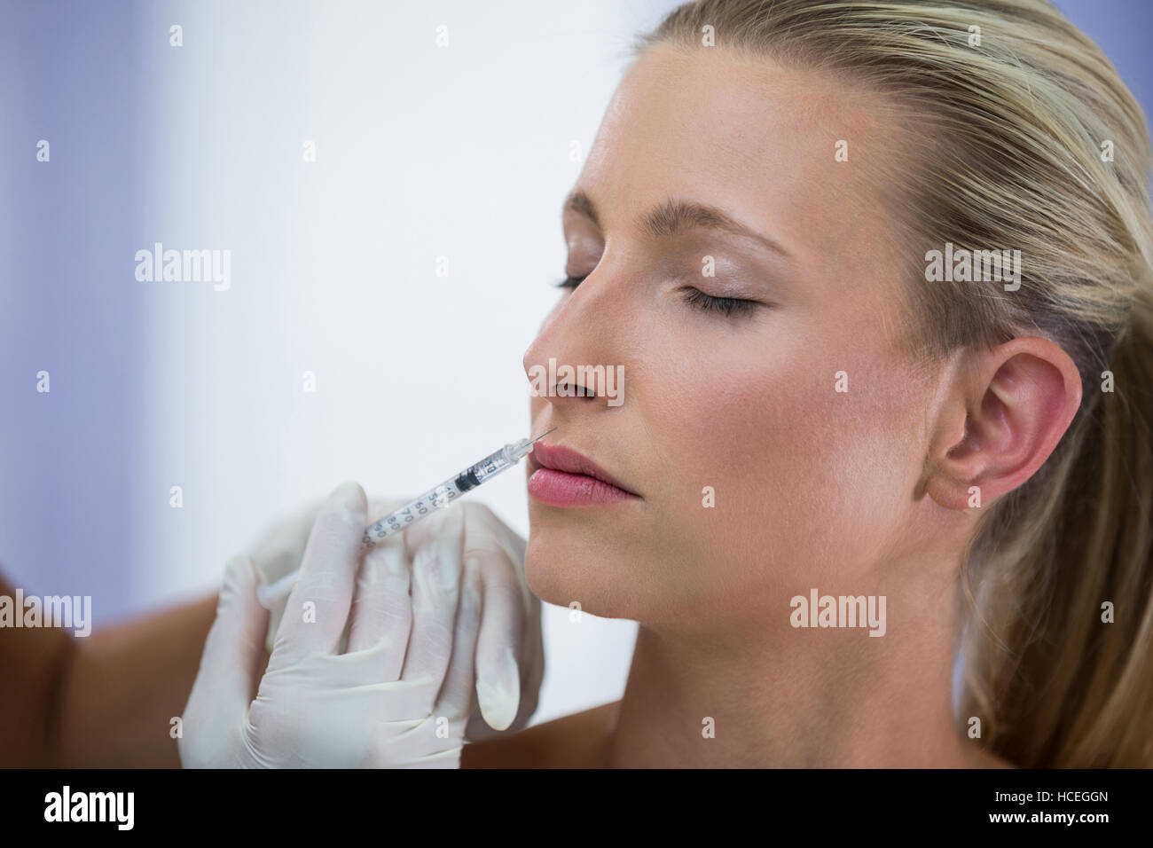 Female patient receiving a botox injection on face Stock Photo - Alamy