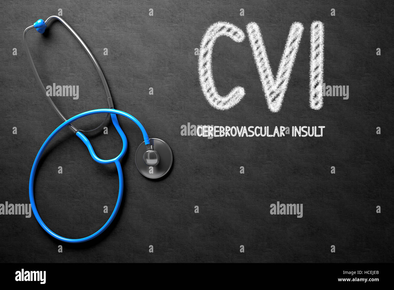 Chalkboard with CVI Concept. 3D Illustration Stock Photo - Alamy