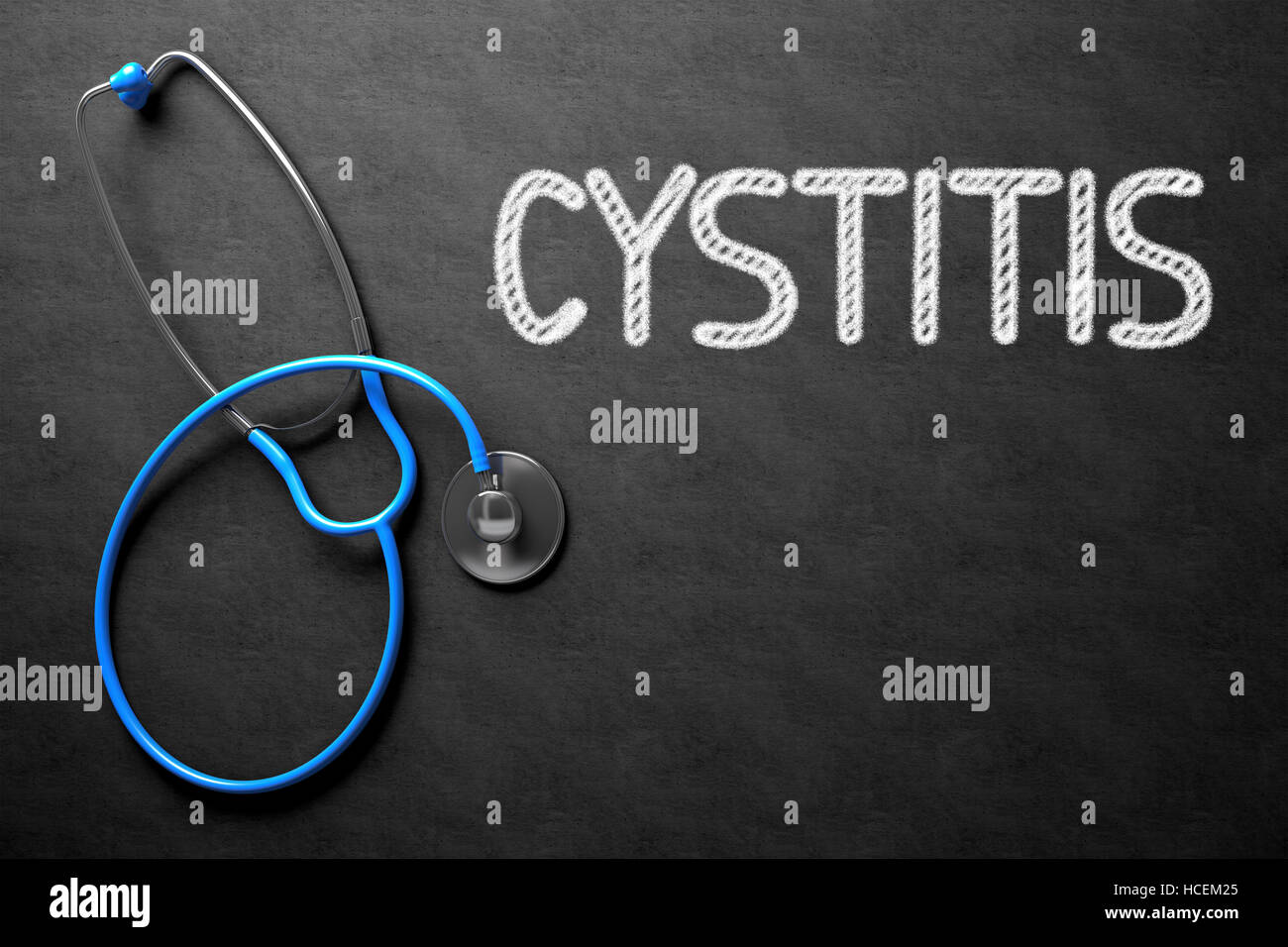 Chalkboard with Cystitis Concept. 3D Illustration Stock Photo - Alamy