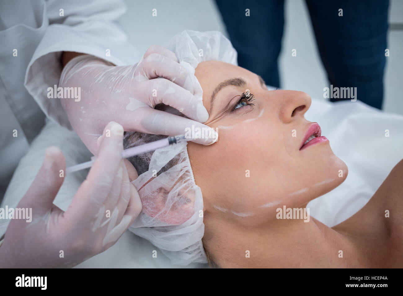 Woman with marked face receiving botox injection Stock Photo - Alamy