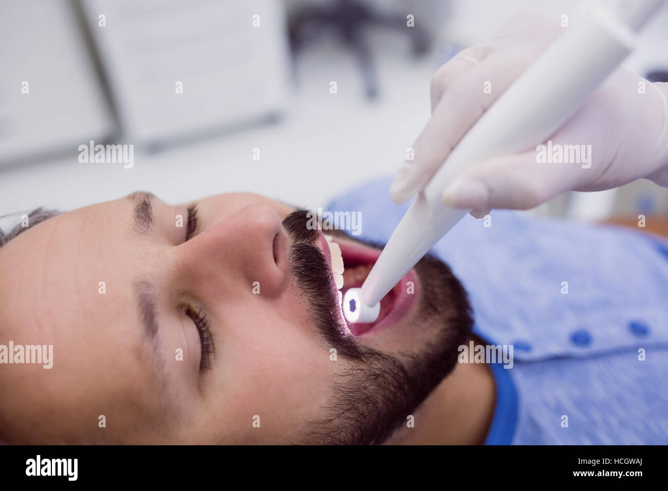 Close-up of patient mouth undergoing dental check up Stock Photo - Alamy