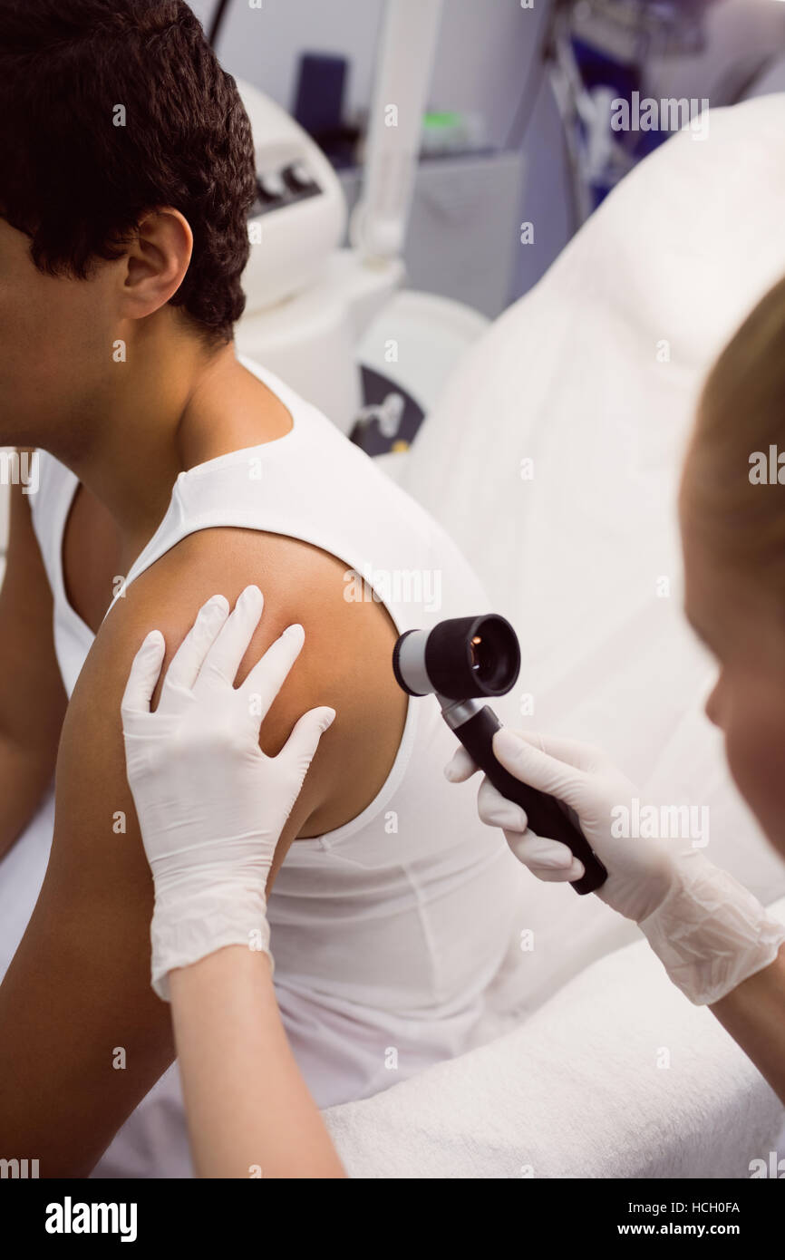 Doctor removing mole with laser treatment Stock Photo - Alamy