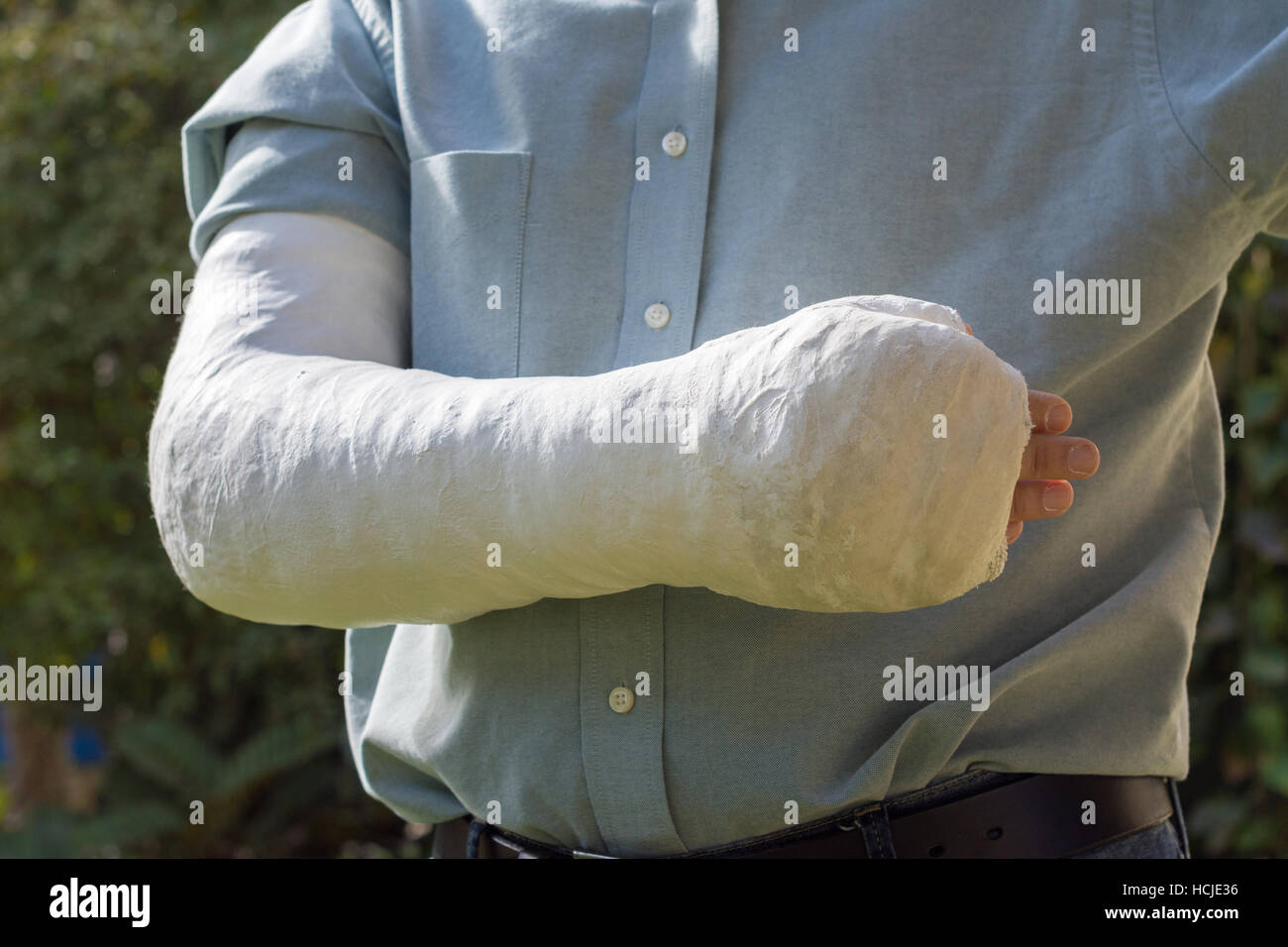 Plaster cast arm hi-res stock photography and images - Alamy