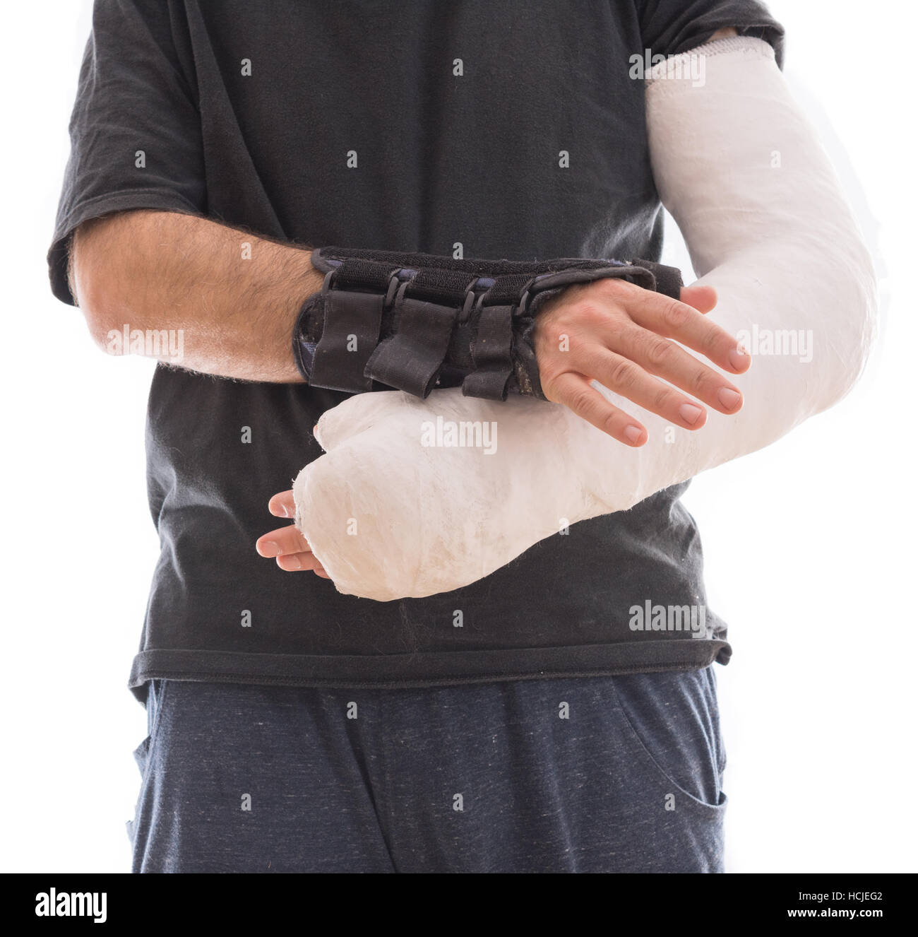 Plaster Splint Gypsum High Resolution Stock Photography and Images - Alamy