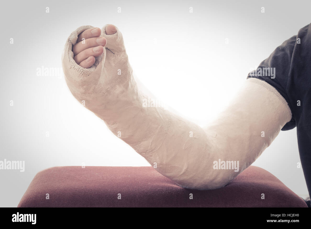 An old fashioned white long arm plasters cast covering the wrist, arm ...