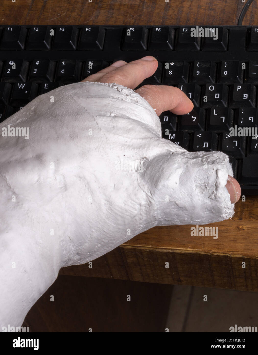 Person wearing an arm cast after breaking their wrist having difficulty ...