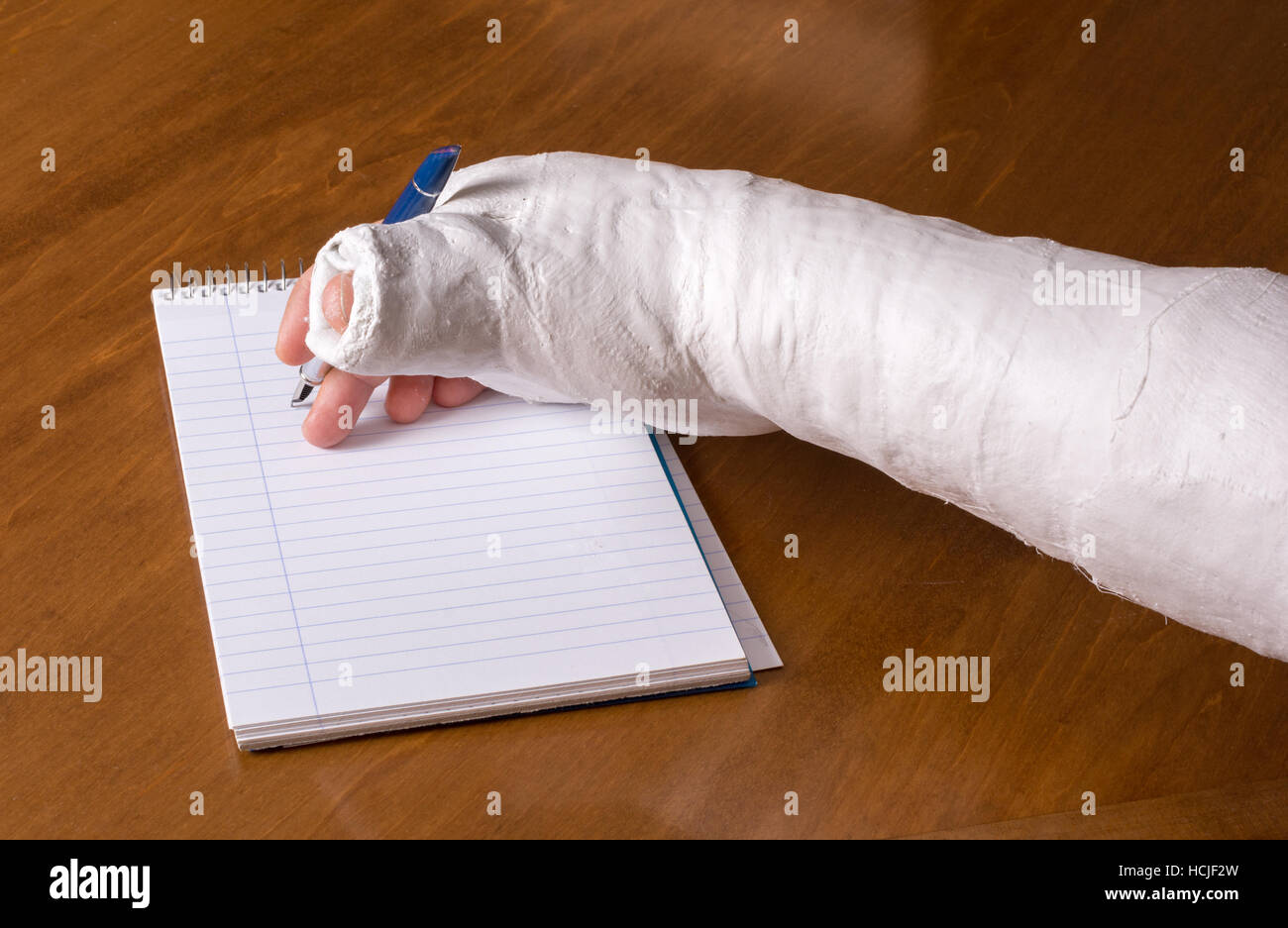 Fracture wrist fall hi-res stock photography and images - Alamy