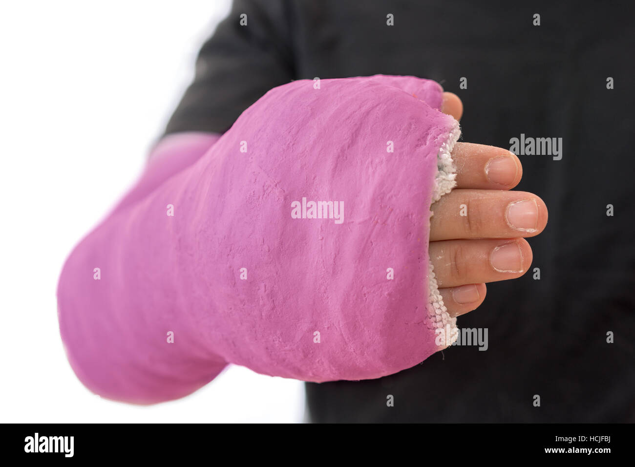 Close up of a pink long arm cast covering the thumb and a part of the ...