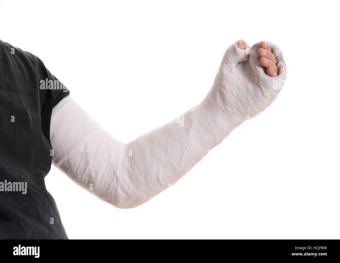 Plaster After Wrist Fracture Stock Photos & Plaster After Wrist ...