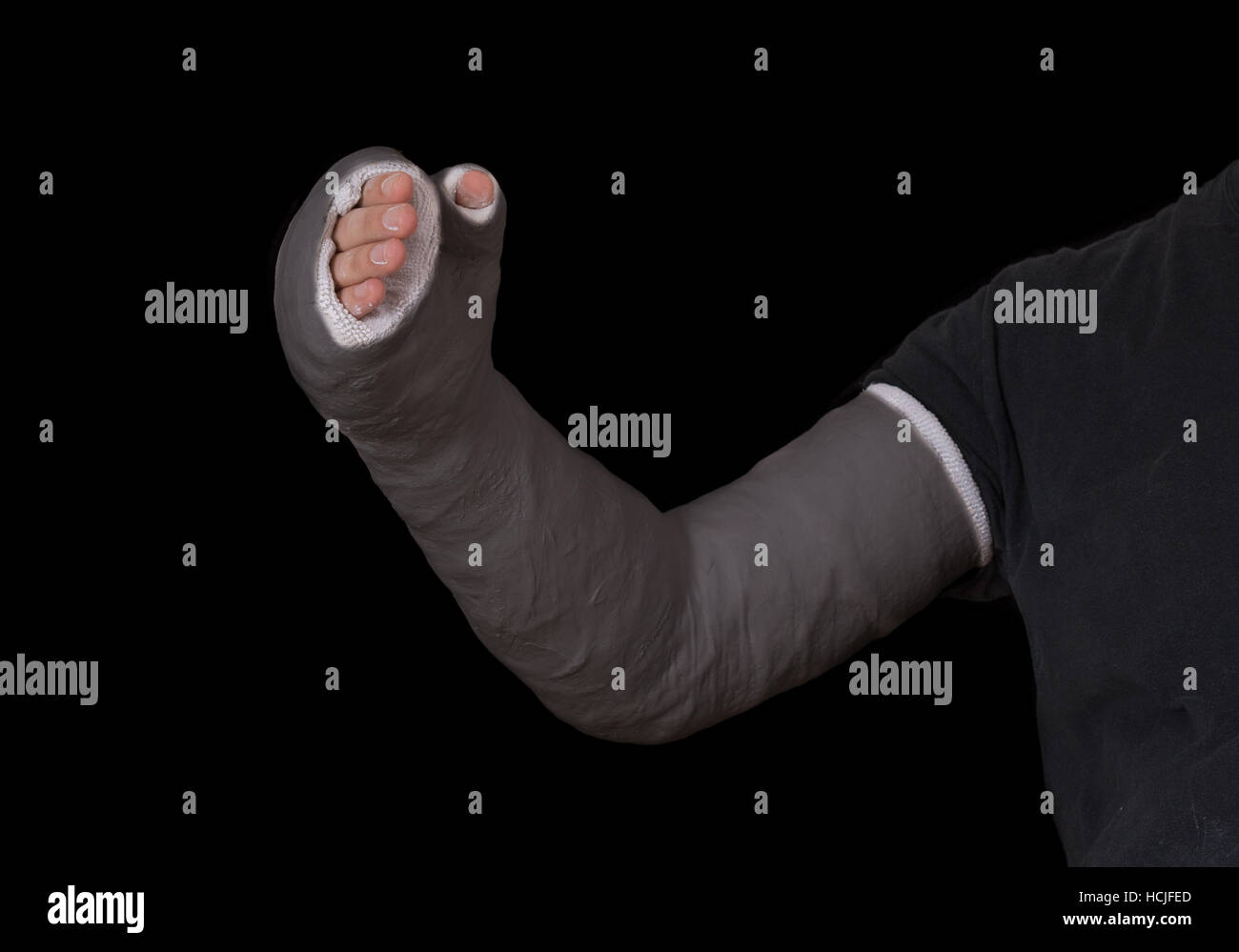 Plaster After Wrist Fracture Stock Photos & Plaster After Wrist ...