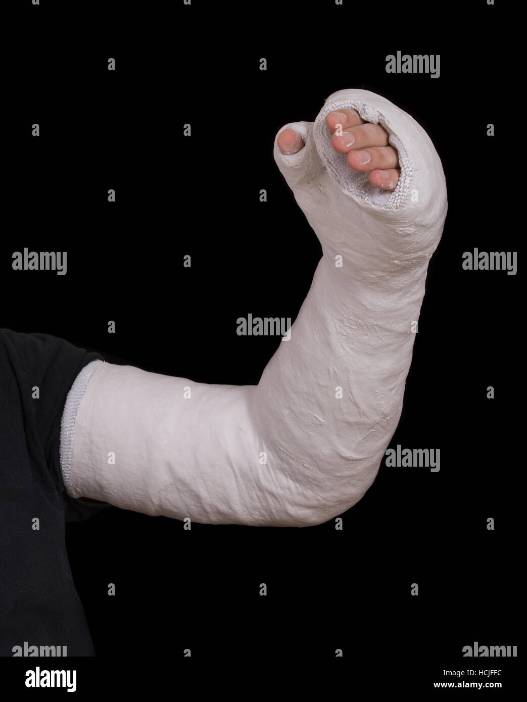 Plaster After Wrist Fracture Stock Photos & Plaster After Wrist ...