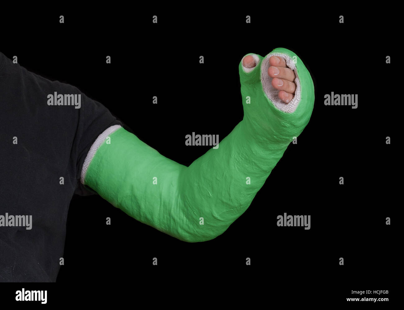 Plaster after wrist fracture hi-res stock photography and images - Alamy