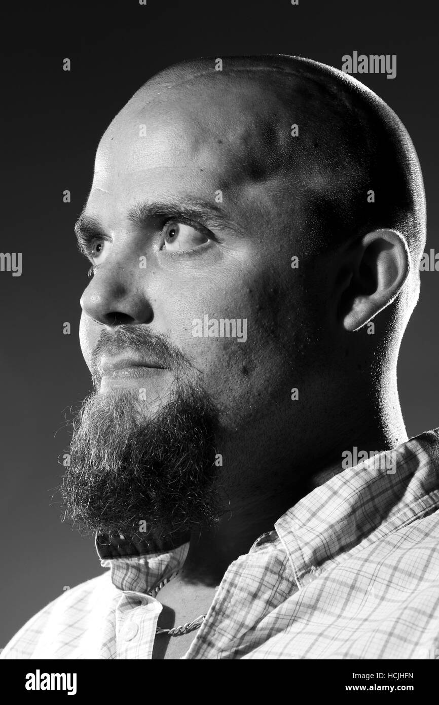 Head scar hi-res stock photography and images - Alamy