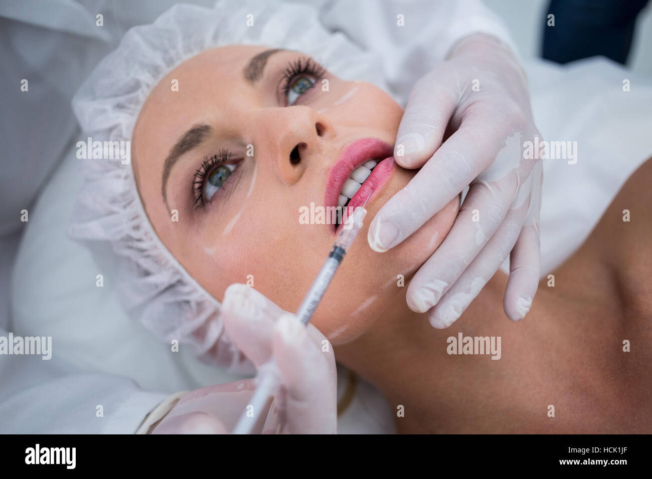 Woman with marked face receiving botox injection Stock Photo - Alamy