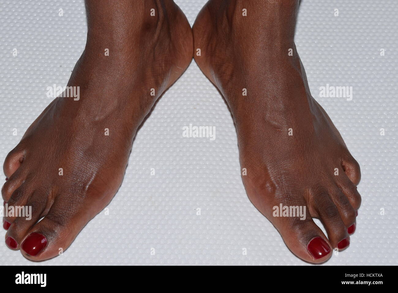 Female foot with prominent veins in an outward Stock Photo - Alamy