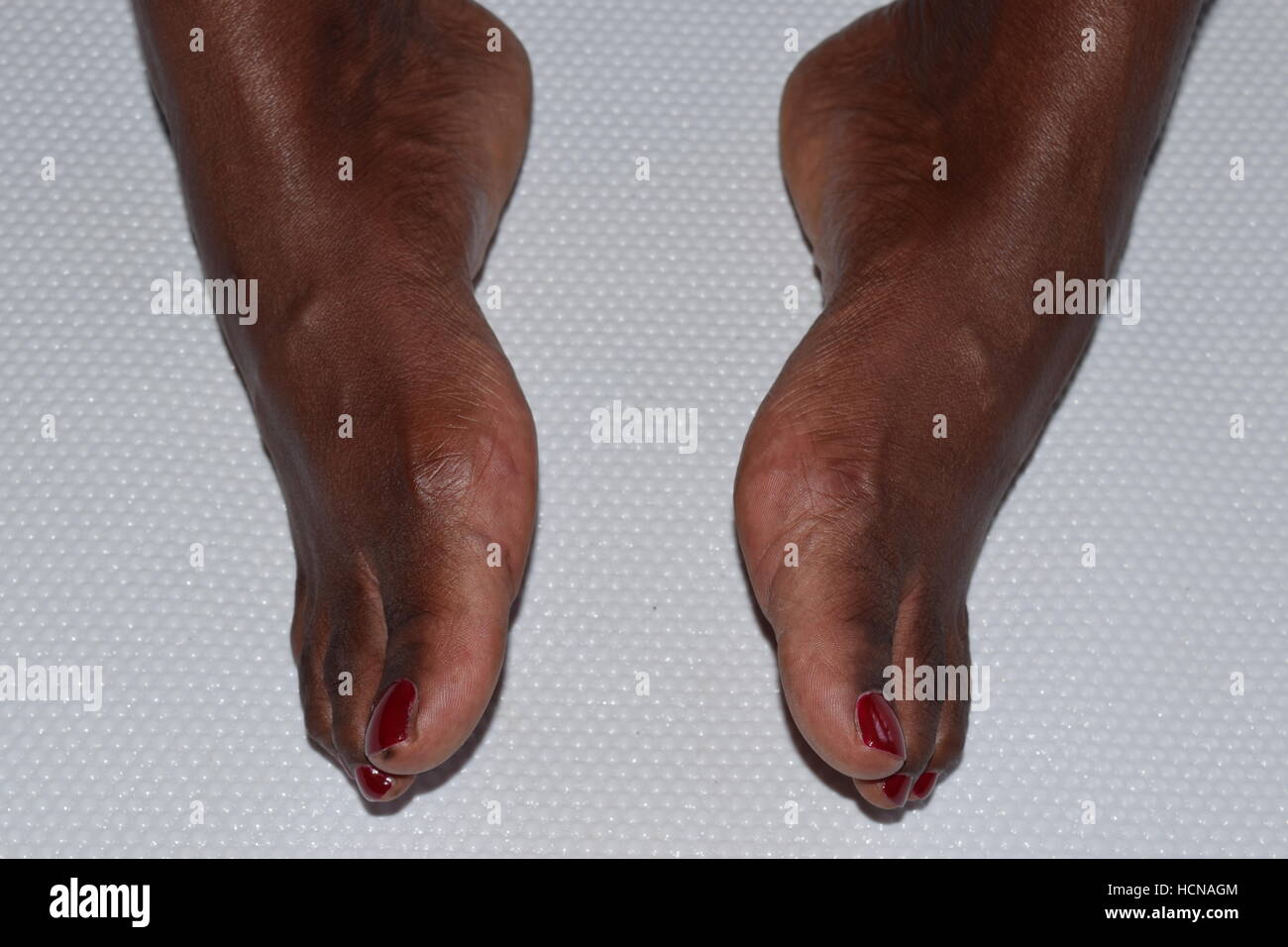 Two female feet facing inwards wearing red nail polish Stock Photo - Alamy