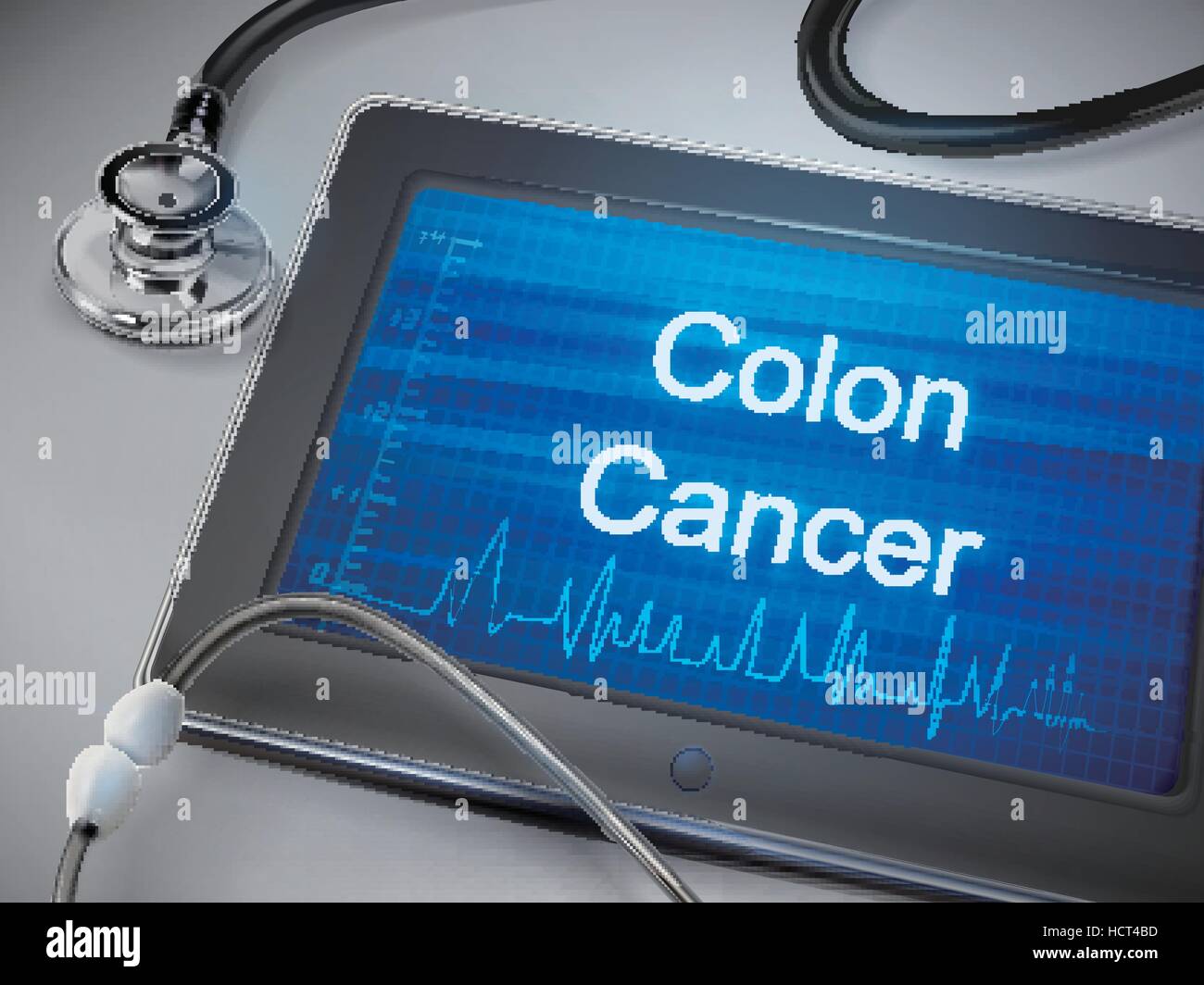 Colonoscopy Stock Vector Images - Alamy
