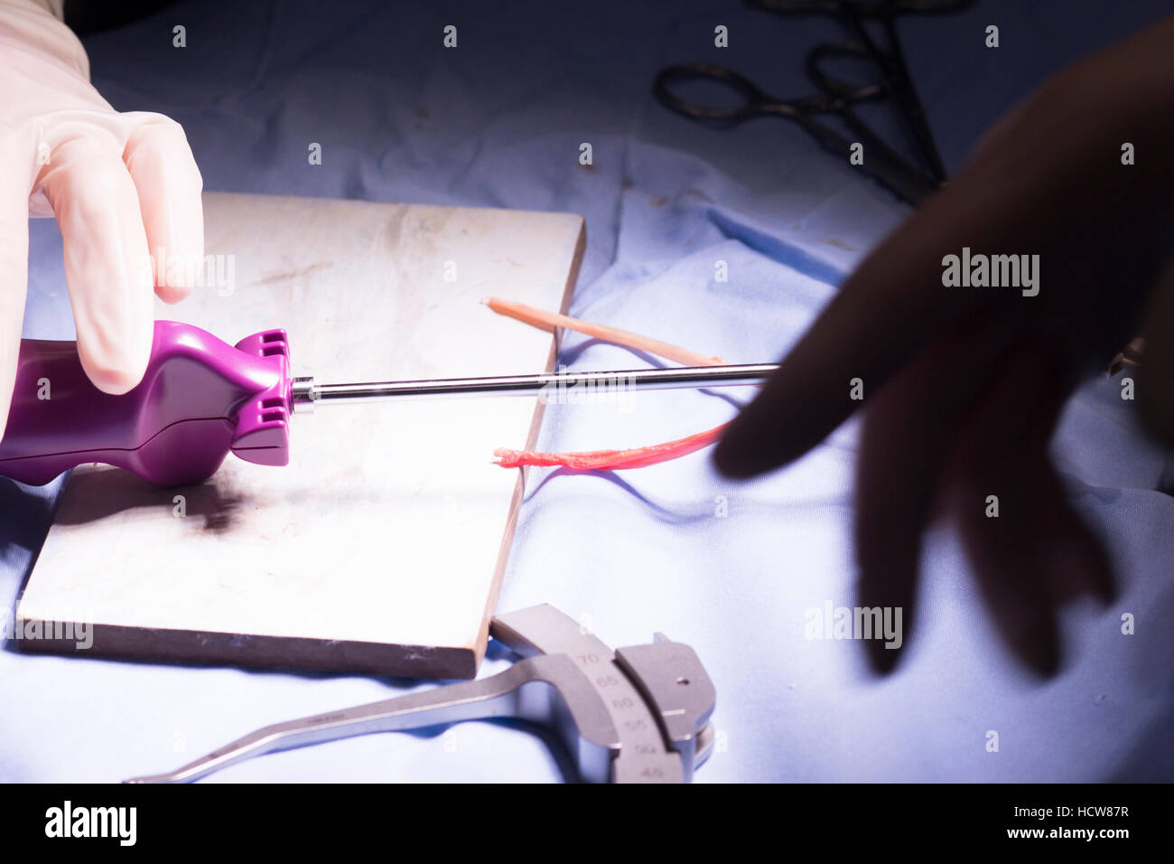 Knee tendon and ligament repair surgery in hospital operating theater ...