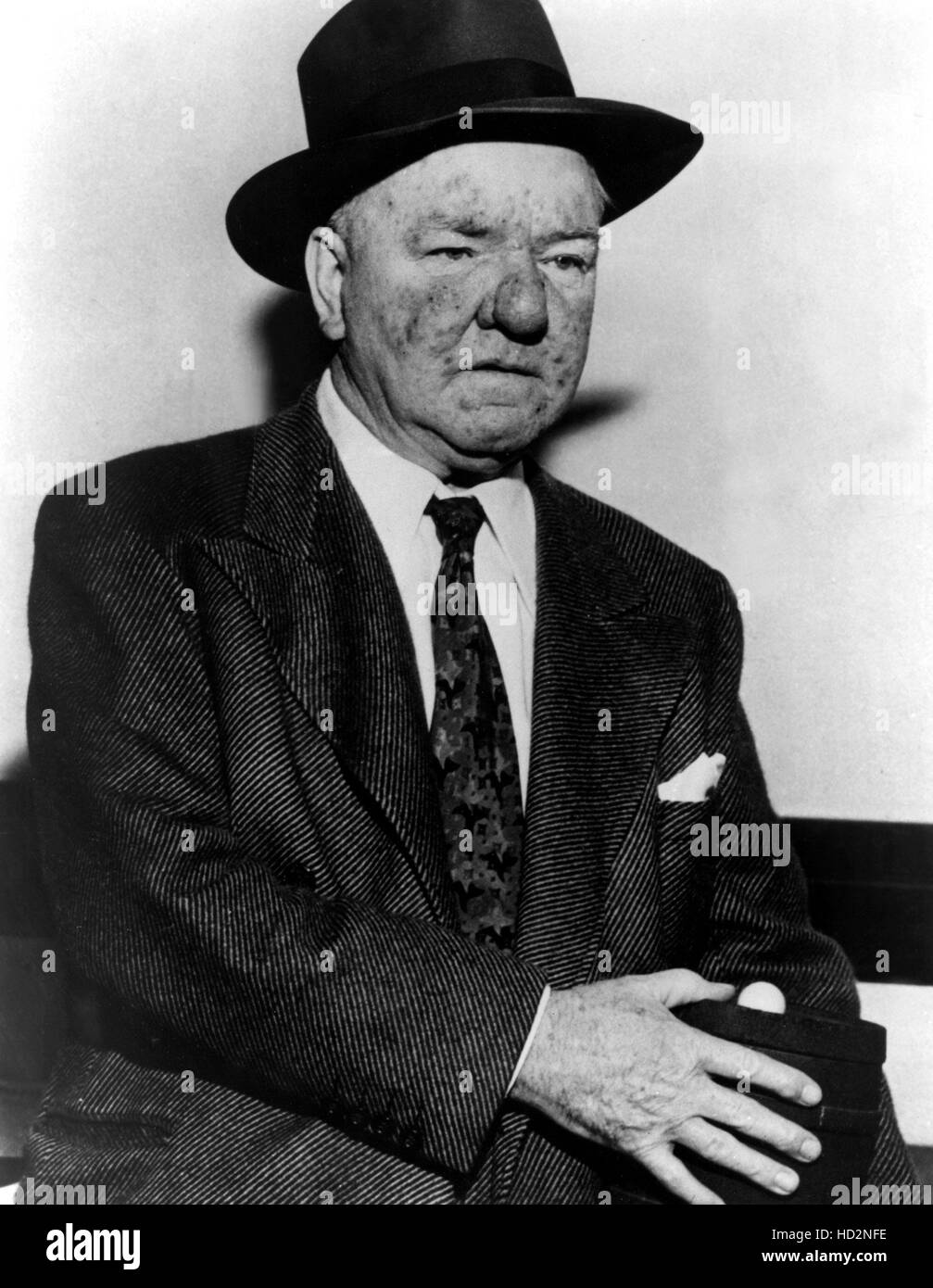 W.C. Fields and the ravages of alcoholism, 1940s Stock Photo - Alamy