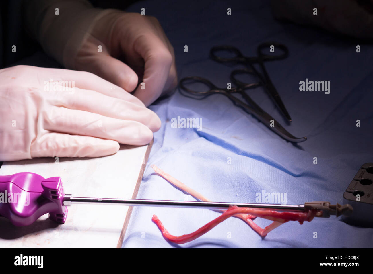 Knee tendon and ligament repair surgery in hospital operating theater ...