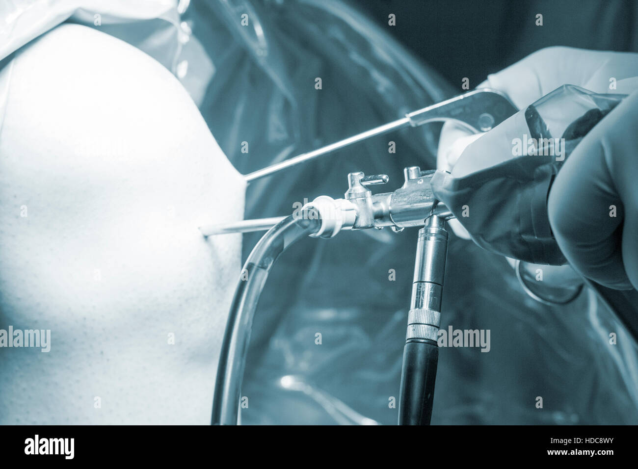 Surgical operation for knee arthroscopy micro surgery in hospital ...