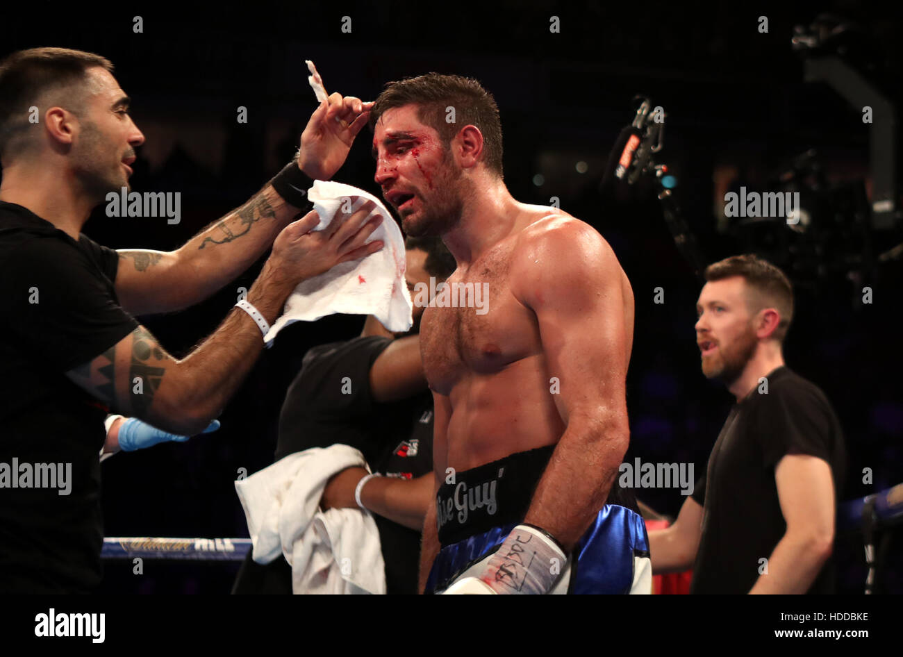 Frank Buglioni is tended to after beating Hosea Burton during their ...