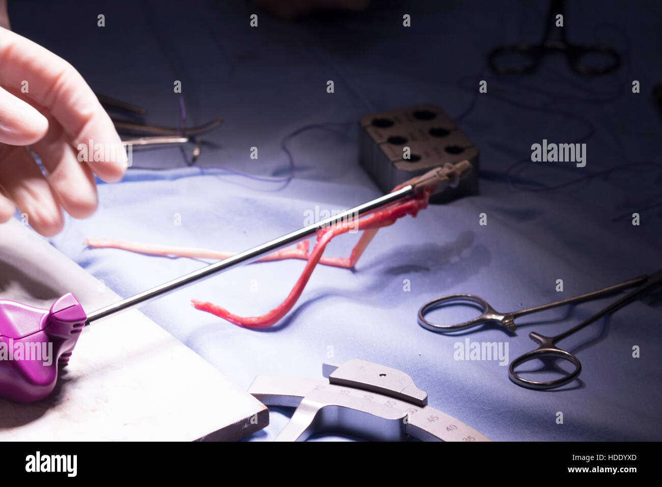 Knee tendon and ligament repair surgery in hospital operating theater ...
