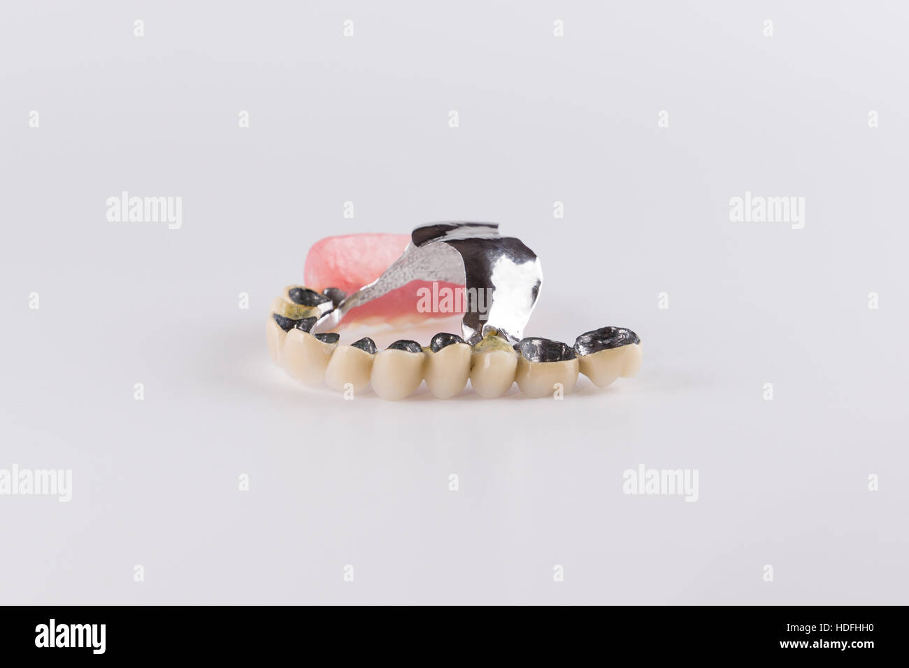 Clasp prosthesis with and attachments fixing ceramic crowns Stock Photo ...