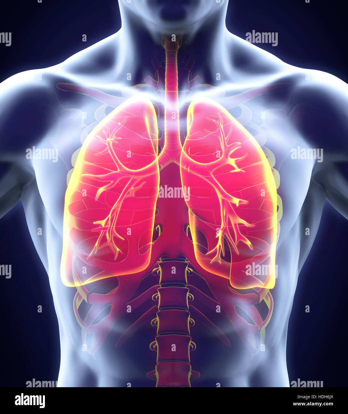 Pneumonia lungs hi-res stock photography and images - Alamy